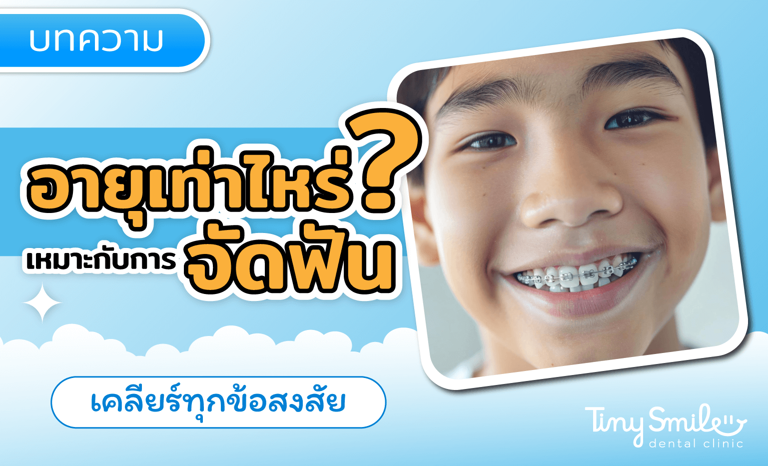 อายุเท่าไหร่เหมาะสมที่สุดสำหรับการจัดฟันเด็ก? - Tiny Smile Dental Clinic