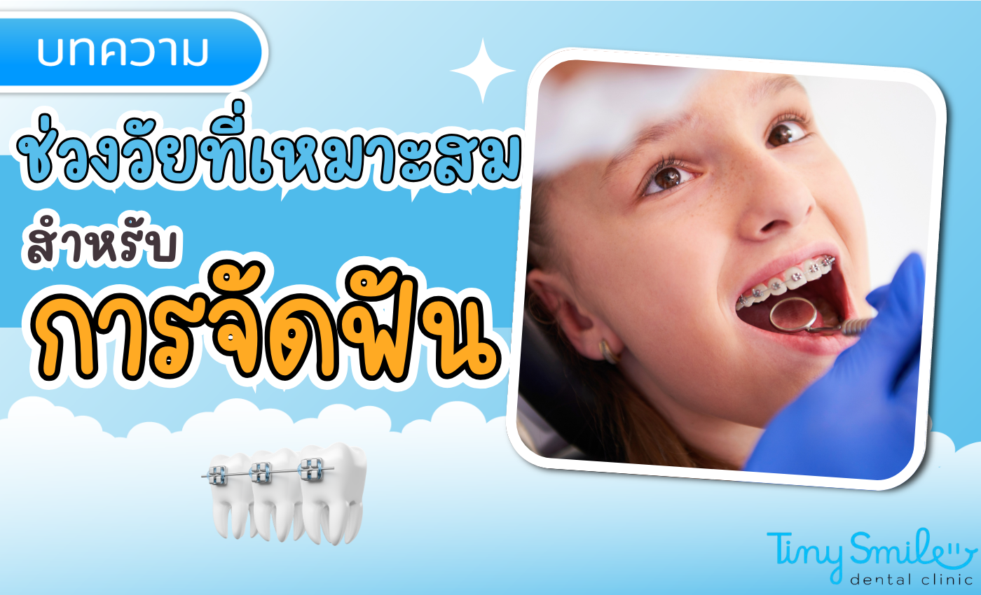ช่วงวัยที่เหมาะสมในการจัดฟัน: คำแนะนำจากผู้เชี่ยวชาญด้านทันตกรรมจัดฟัน ...
