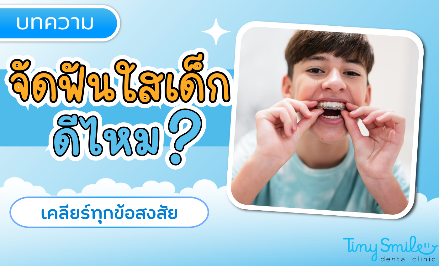 จัดฟันใสเด็กดีไหม? รู้ก่อนจัดฟันใส Invisalign สำหรับลูกวัย 6-19 ปี ...