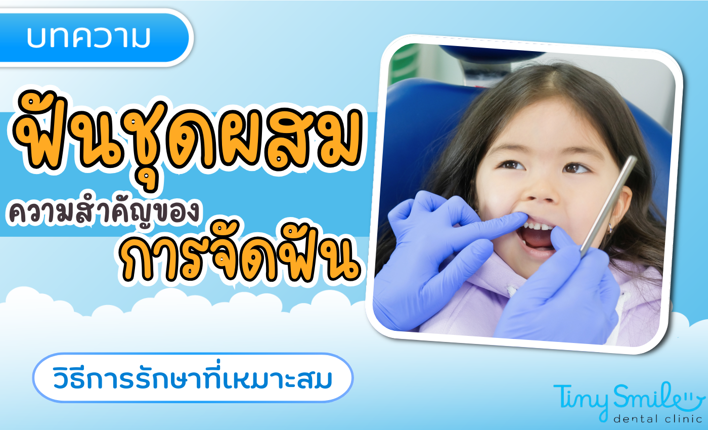 เข้าใจ "ฟันชุดผสม" และความสำคัญของการจัดฟันในช่วงวัยนี้ - Tiny Smile ...