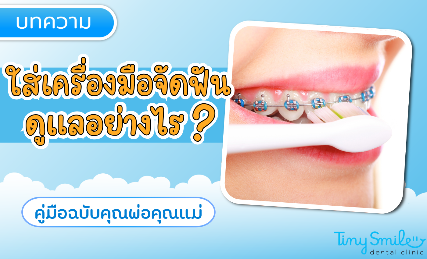 เด็กใส่เครื่องมือจัดฟันดูแลอย่างไร - คู่มือฉบับคุณพ่อคุณแม่ - Tiny ...