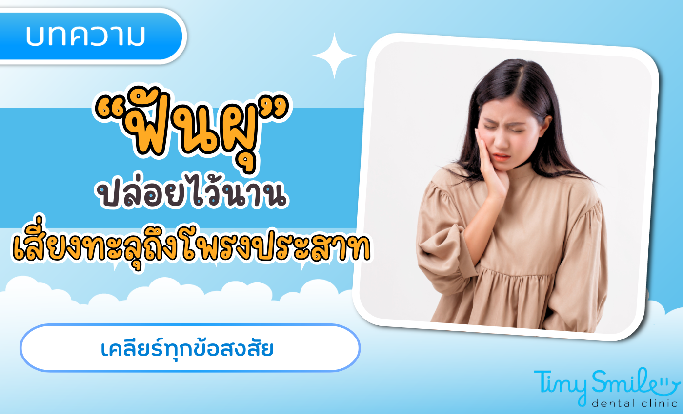 ฟันผุ ปล่อยไว้นาน เสี่ยงทะลุถึงโพรงประสาท - Tiny Smile Dental Clinic