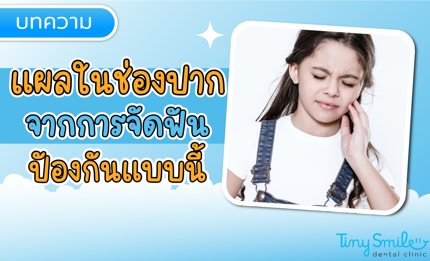 แผลในช่องปากจากการจัดฟันเด็ก: วิธีรักษาและป้องกันที่พ่อแม่ต้องรู้ ...